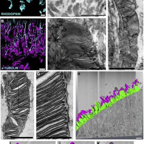 Ultrastructure Analysis Of Photoreceptor Cells With Improved Outer Download Scientific Diagram