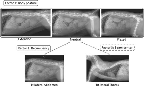 Enlarged Liver X Ray