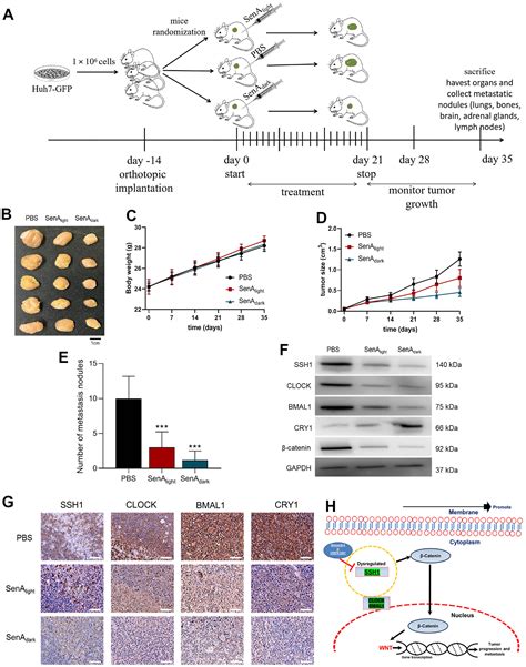 Dysregulated Expression Of Slingshot Protein Phosphatase 1 Ssh1 Disrupts Circadian Rhythm And