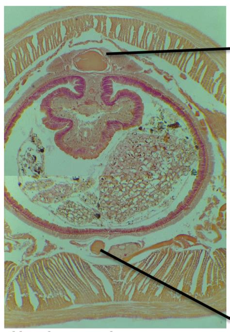 Lab 3 Earthworm Cross Section 1 Diagram Quizlet