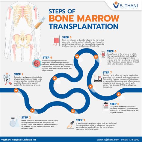 Bone Marrow Transplant Thailand Yyddl