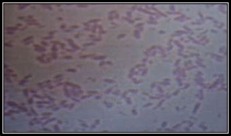 Gram Stain Of H Pylori Isolated From Patient With Peptic Ulcer Download Scientific Diagram