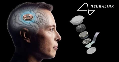 Neuralink From Brain To Computer
