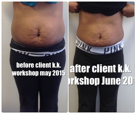All New Before And After Pictures Healing The Diastasis Recti Beautiful After The Belly
