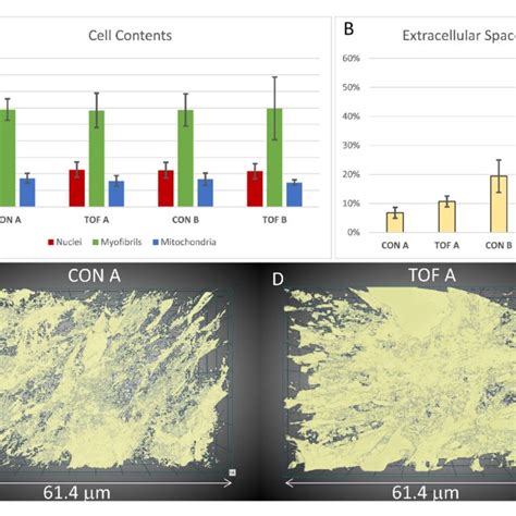 segmentation and quantification of sbf sem images selected images n