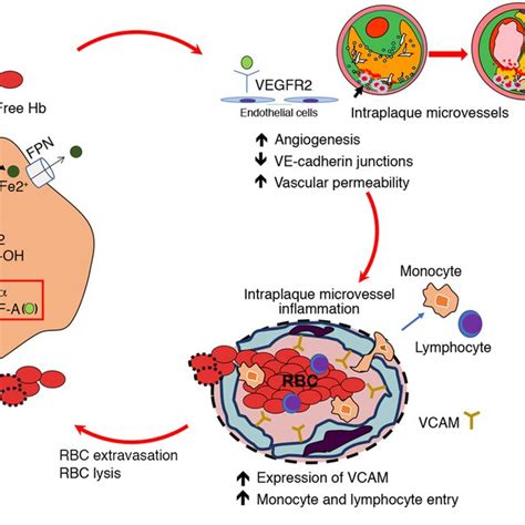 Summary Of The Role Of Mhb Macrophages In Plaque Angiogenesis