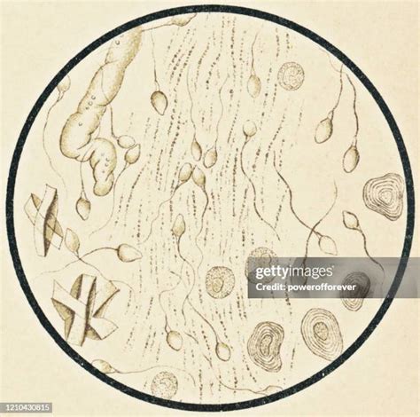 Semen Under Microscope