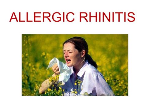 Allergic Rhinitis Symptoms Signs Treatment Ent Ppt Pptx