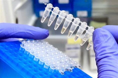 Dna Fragments Are Separated Through A Capillary Electrophoresis Machine