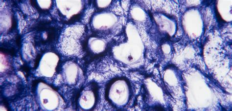 Connective Tissue Elastic Cartilage