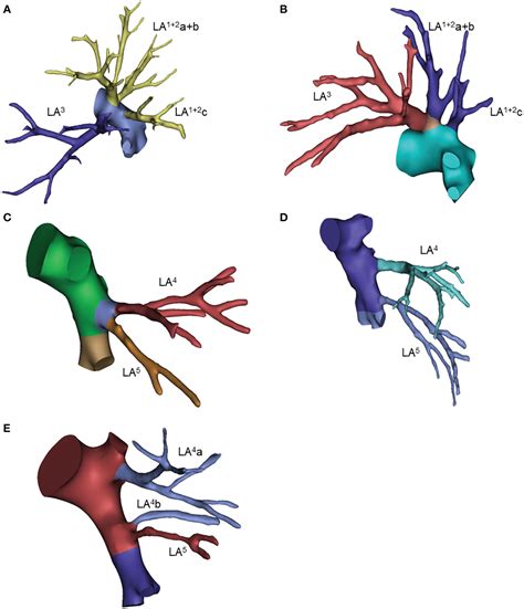 Frontiers An Atlas Of Anatomical Variants Of Subsegmental Pulmonary Arteries And Recognition