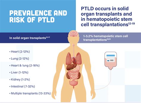 Ebv Ptld Pierre Fabre Oncology