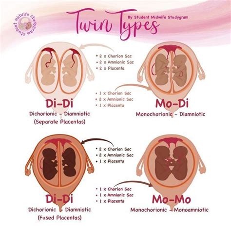 Pin By Ayla Schuetze On Types Of Twins Babe Midwife Midwife Nursing Babe Tips