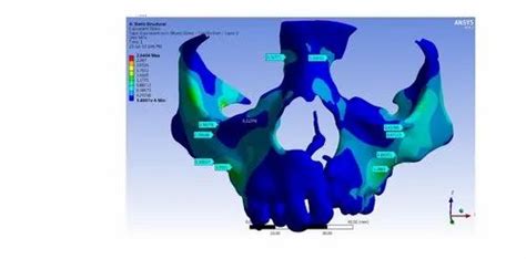 Computer Aided Engineering Analysis Using Ansys Abacus Msc Softwares