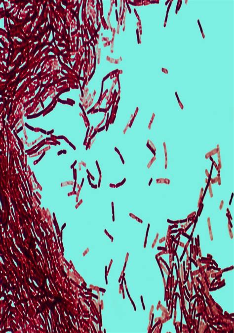 Streptobacillus Bacteria Buymicroart Streptobacillus Bacteria Buymicroart