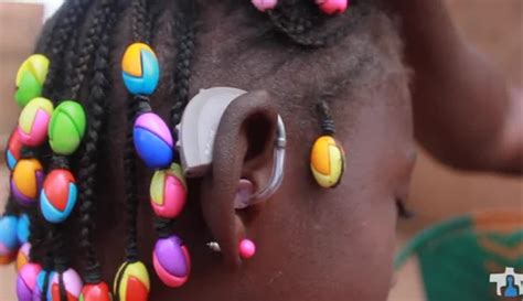 Desktop Auditory Brainstem Response Machine For Hospital Model Namenumber Duet At Rs 575000