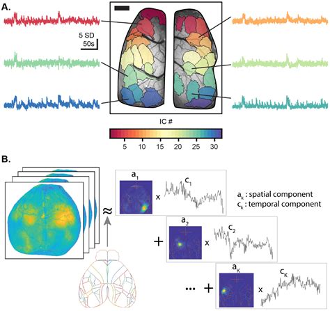 Wide Field Calcium Imaging Of Neuronal Network Dynamics In Vivo