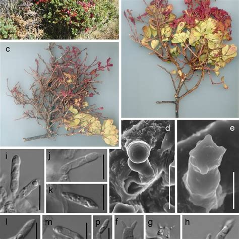 Basidia And Basidiospores Of Exobasidium Darwinii From Holotype Kram