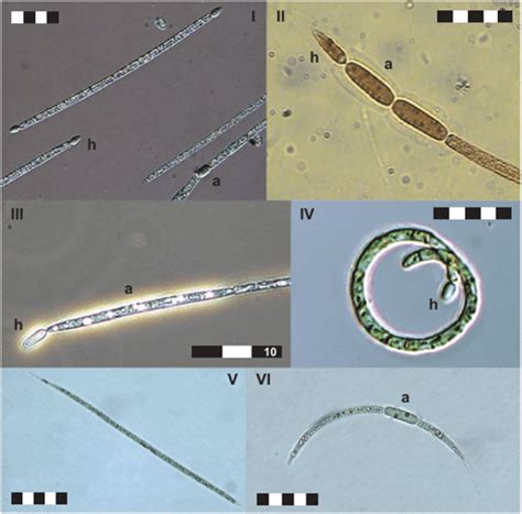 Major Cyanobacterial Groups Description Of Common Toxigenic And Bloom