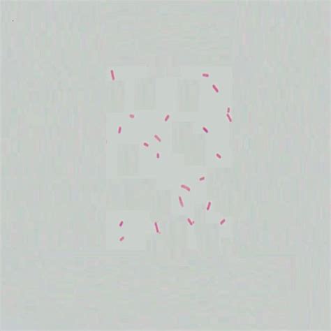 Ecoli Object Detection Dataset And Pre Trained Model By Objectd