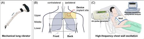 Chest Physiotherapy Vibration Vest
