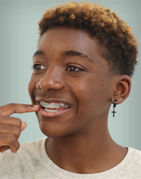 Metal Braces Near You Best Orthodontists In Abu Dhabi