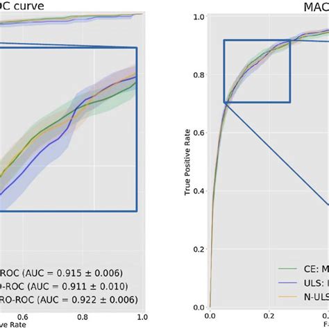 Bootstrapped Roc Curve Resulting From Training A Resnet50 Left And A