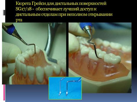 Лекция №4 Заболевания пародонта - online presentation