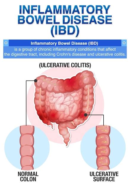 Digestive System Clipart Images Free Download On Freepik
