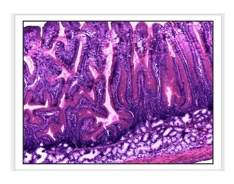 Small Intestine Duodenum — Printable Worksheet