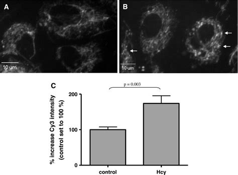 Effect Of Hcy On Mitochondrial Membrane Potential ΔΨm Ac Analysis