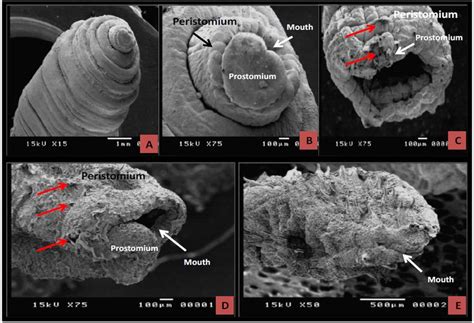 Scanning Electron Photomicrograph Of The Anterior Part Of Earthworm
