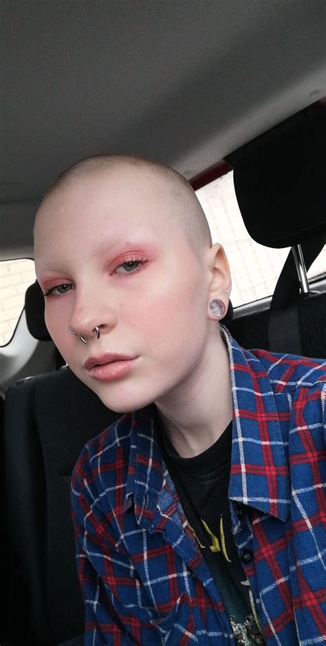 900 Bald Girls Ideas In 2025 Bald Girl Balding Bald Women