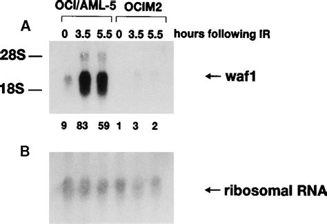 Figure 2 From A Functional Wild Type P53 Gene Is Expressed In Human