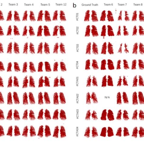 Pdf Automated Vessel Segmentation In Ct And Cta Scans Of The Lung Via Deep Neural Networks