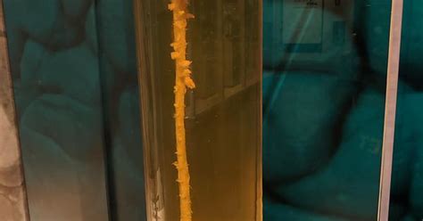 Brain And Spinal Cord From 1935 Album On Imgur