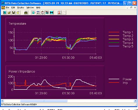 Figure 3 From Data Acquisition For Radiofrequency Ablation Simulation Semantic Scholar