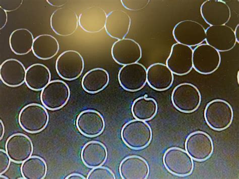 Live Blood Cell Microscopy Maddalene Rose Spa