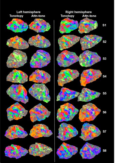 Individual Subjects Tonotopy And Attentiontonotopy Maps Each Download Scientific Diagram