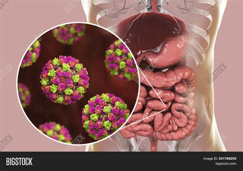 Norovirus Human Image And Photo Free Trial Bigstock