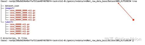Nnu Net学习笔记系列1：安装和训练 知乎