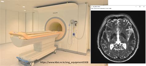 Seungkyuns Magnetic Resonance Life Blog 7t Mri At Kbsi