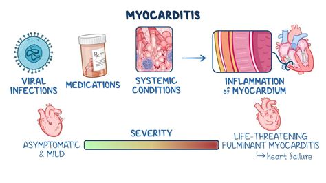 Video Myocarditis Clinical Sciences Osmosis