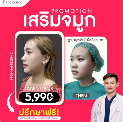 เสริมจูกใหม่ 5990฿ 😍😍 รณภีร์คลินิก รังสิต