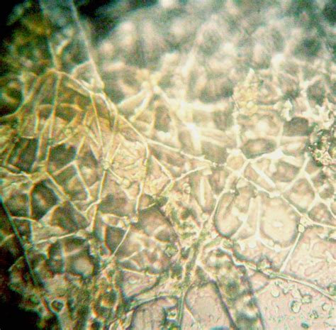 Evaluation Of The Efficiency Of Some Antagonistic Trichoderma Spp In The Management Of Plant