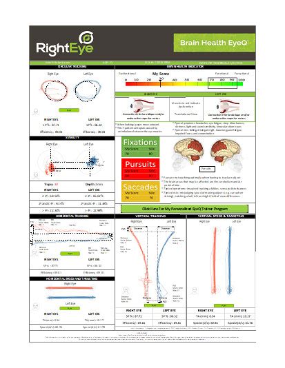 Brain Function Assessment Technology Brain Balanz