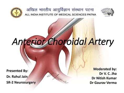 Anterior Choroidal Arterypptx