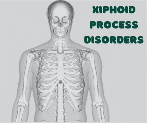 7 Warning Signs Of Xiphoid Process Disorders