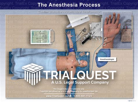 The Anesthesia Process Trialquest Inc