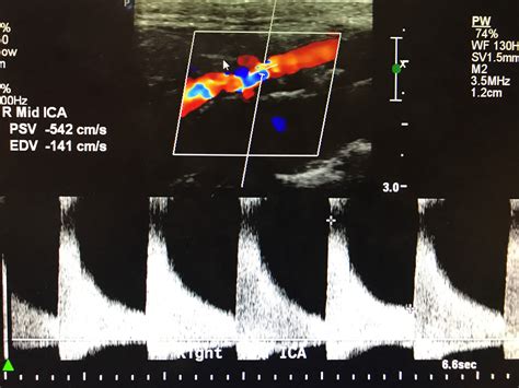 Advance Diagnostics Laboratories Corporation Carotid Duplex